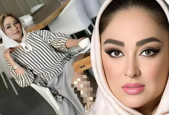 الهام حمیدی بعد از عمل لیپوماتیک 20 سال جوان شد عکس جنجالی الهام